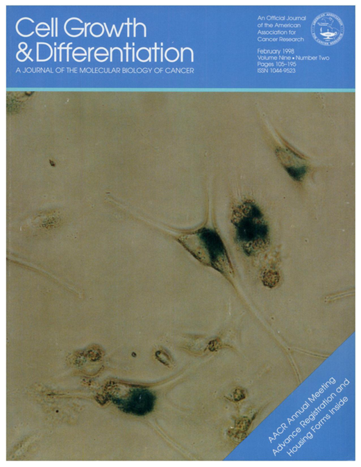 Transformation-sensitive changes in expression, localization, and ...