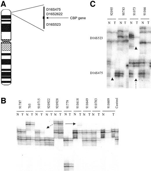 Loss of Heterozygosity and Internal Tandem Duplication Mutations of the ...
