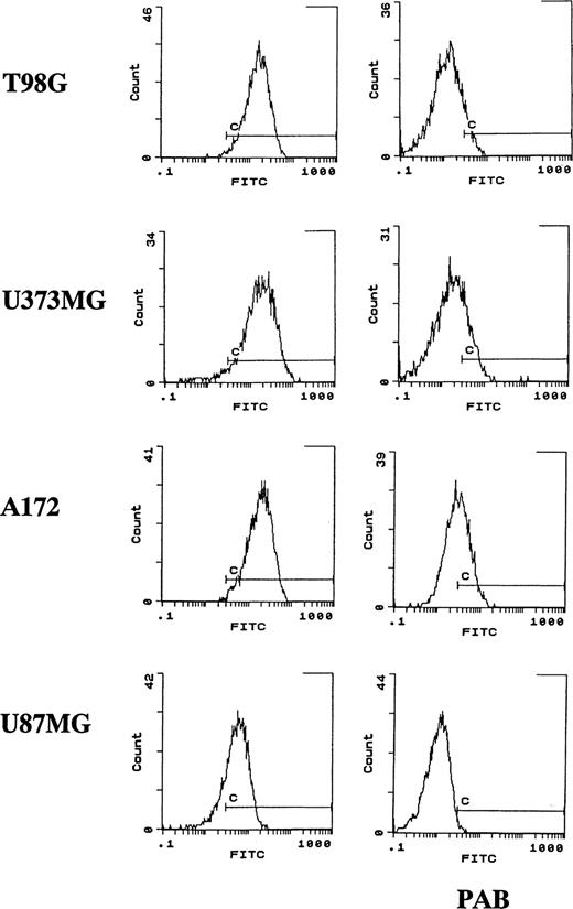 Impairment of Both Apoptotic and Cytoprotective Signalings in Glioma ...