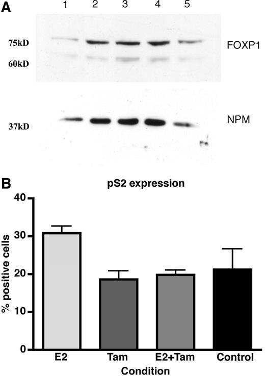 Expression of the Forkhead Transcription Factor FOXP1 Is Associated ...