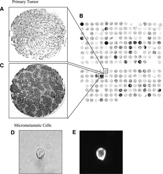 Expression of Extracellular Matrix Metalloproteases Inducer on ...