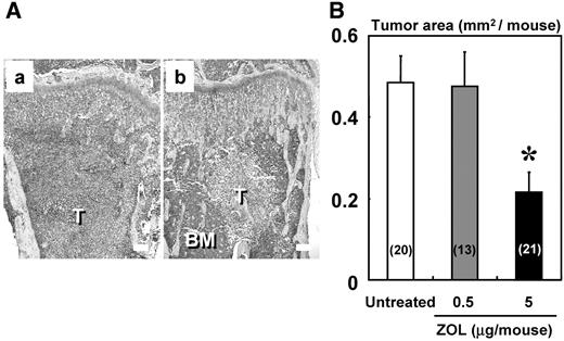 Zoledronic Acid Inhibits Visceral Metastases in the 4T1/luc Mouse ...