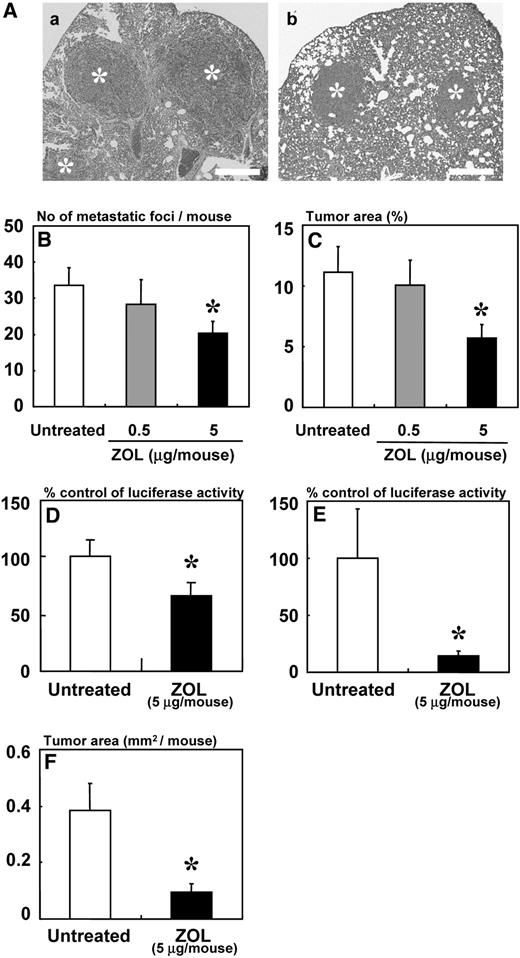 Zoledronic Acid Inhibits Visceral Metastases in the 4T1/luc Mouse ...