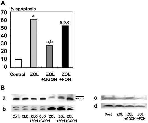Zoledronic Acid Inhibits Visceral Metastases in the 4T1/luc Mouse ...
