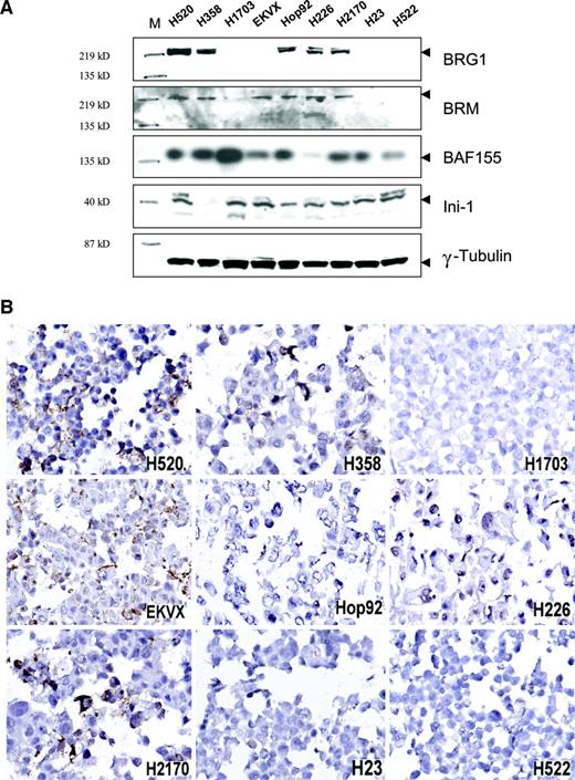 Chromatin Remodeling Factors and BRM/BRG1 Expression as Prognostic ...