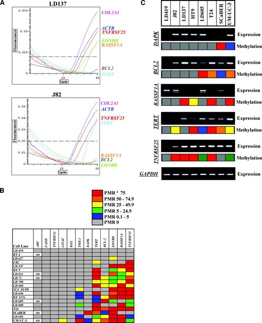 Detection of Methylated Apoptosis-Associated Genes in Urine Sediments ...