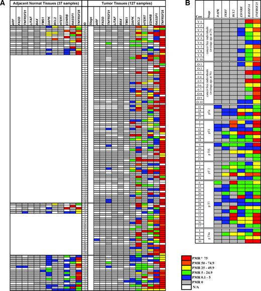 Detection of Methylated Apoptosis-Associated Genes in Urine Sediments ...