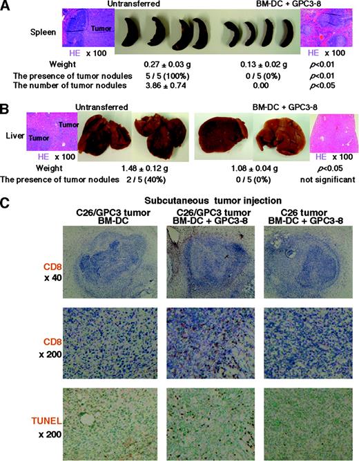 Mouse Homologue of a Novel Human Oncofetal Antigen, Glypican-3, Evokes ...