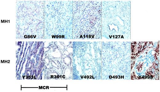 Missense Mutations of MADH4 | Clinical Cancer Research | American ...