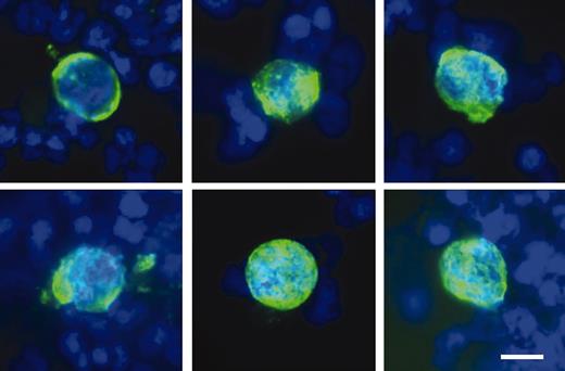 Reliable and Sensitive Identification of Occult Tumor Cells Using the ...