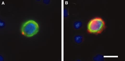 Reliable and Sensitive Identification of Occult Tumor Cells Using the ...