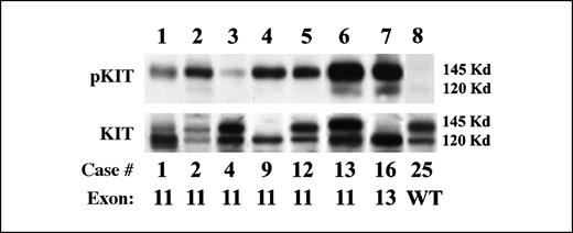 Analysis of KIT Mutations in Sporadic and Familial Gastrointestinal ...