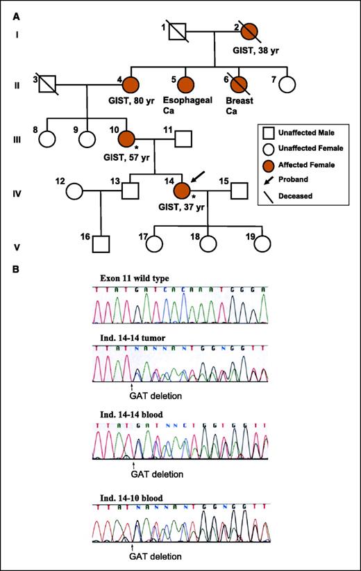 Analysis of KIT Mutations in Sporadic and Familial Gastrointestinal ...