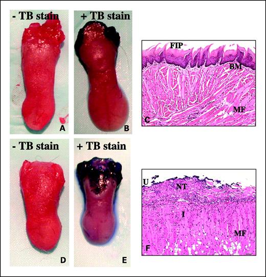 Evaluation of Radiation-Induced Oral Mucositis by Optical Coherence ...
