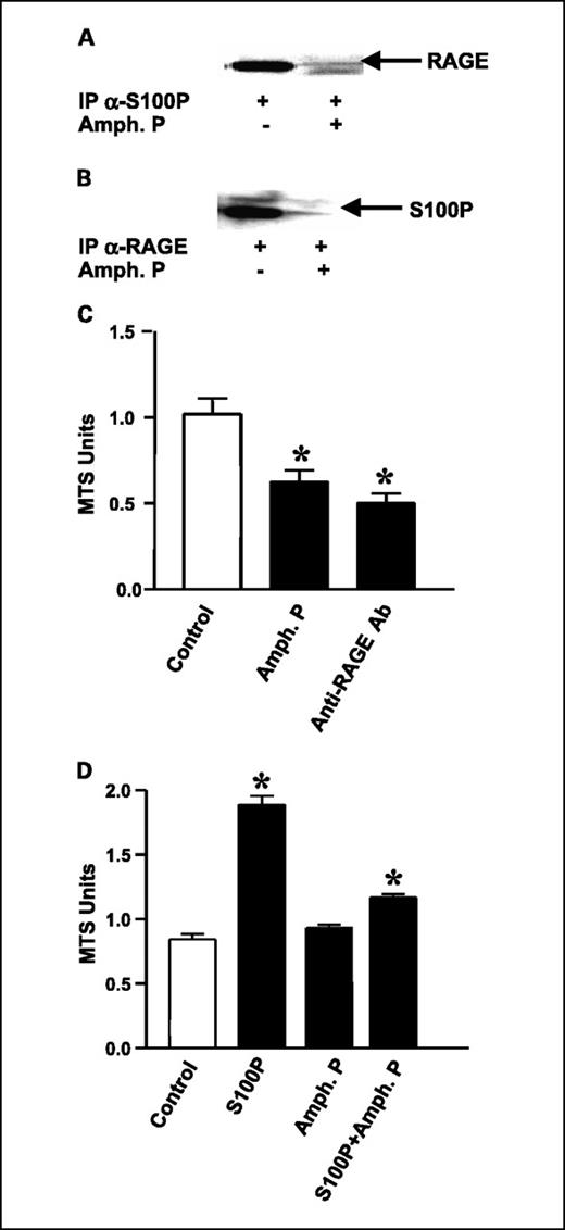 S100P Promotes Pancreatic Cancer Growth, Survival, and Invasion ...