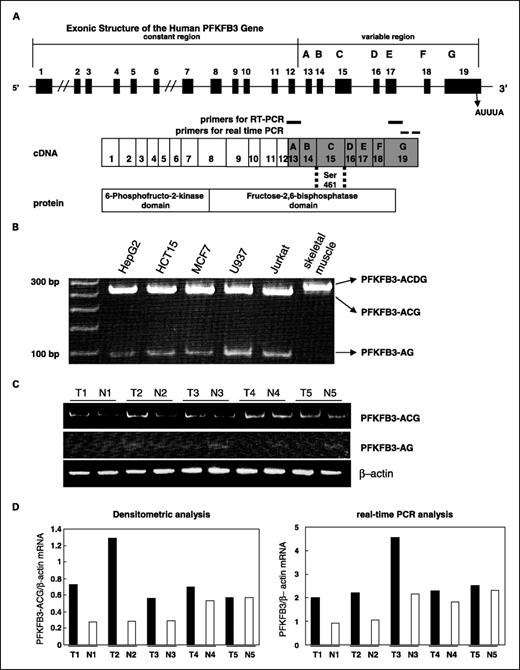 Phosphorylation of the 6-Phosphofructo-2-Kinase/Fructose 2,6 ...
