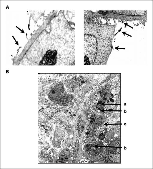 Development of Tumor Targeting Bioprobes (111In-Chimeric L6 Monoclonal ...