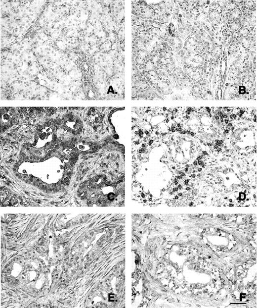 Control of T-Cell–Mediated Immune Response by HLA Class I in Human ...