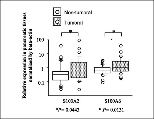 The Role of S100A6 in Pancreatic Cancer Development and Its Clinical ...