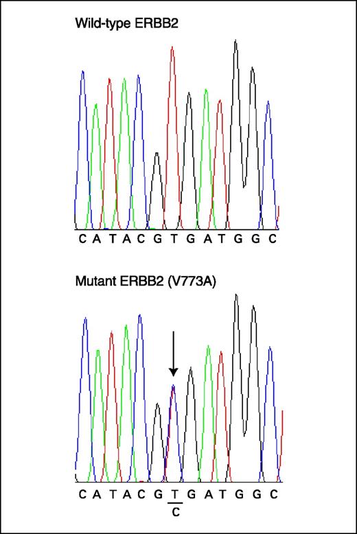 Response of Some Head and Neck Cancers to Epidermal Growth Factor ...