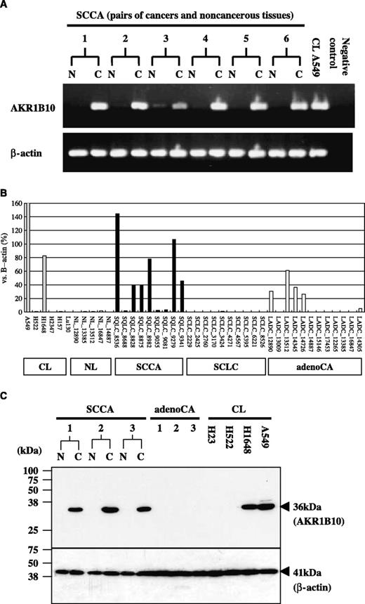 Overexpression of the Aldo-Keto Reductase Family Protein AKR1B10 Is ...