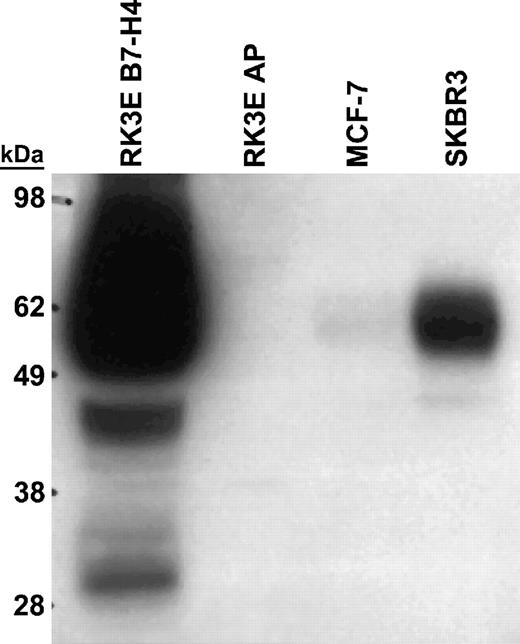 B7-H4 Is Highly Expressed in Ductal and Lobular Breast Cancer ...