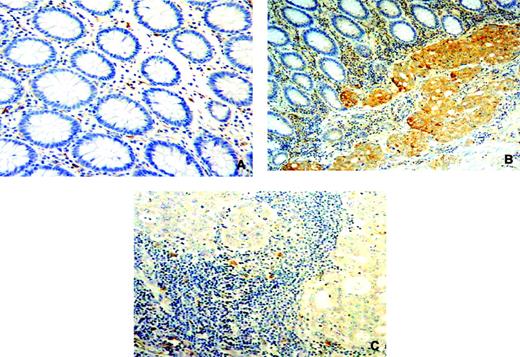 Legumain Expression in Relation to Clinicopathologic and Biological ...