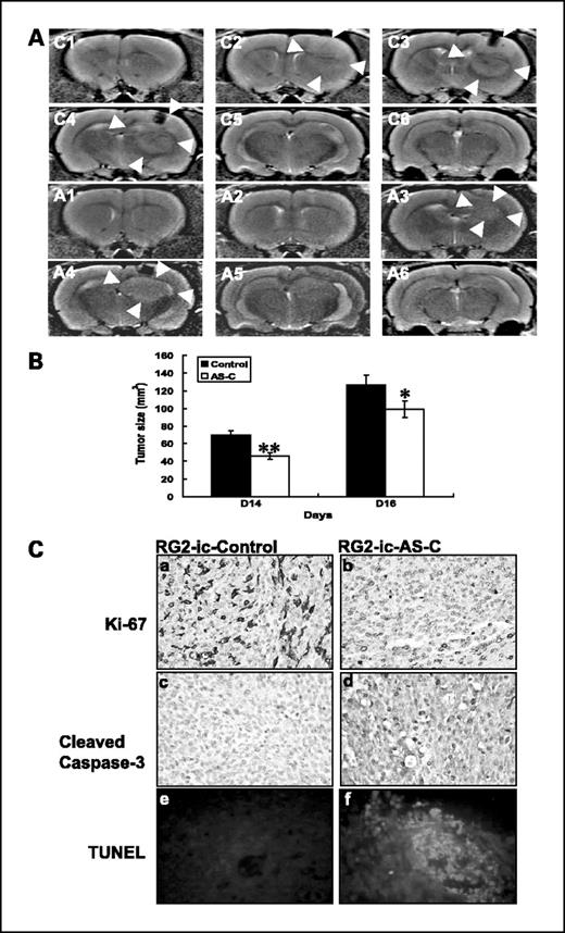 The Antitumor Effects of Angelica sinensis on Malignant Brain Tumors In ...