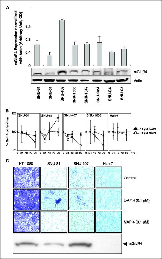 Metabotropic Glutamate Receptor 4 Expression in Colorectal Carcinoma ...