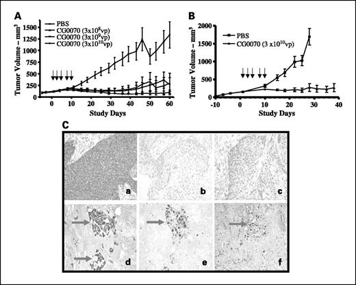 CG0070, a Conditionally Replicating Granulocyte Macrophage Colony ...