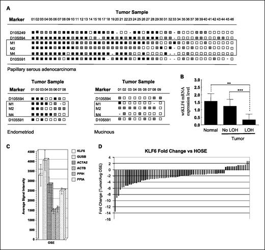 Roles of KLF6 and KLF6-SV1 in Ovarian Cancer Progression and ...