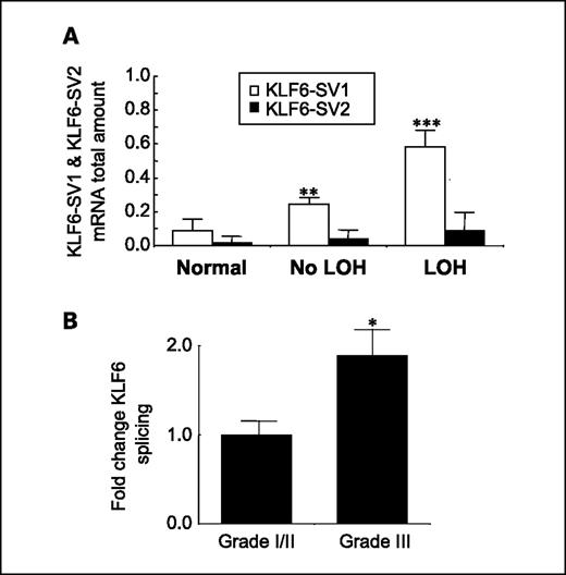 Roles of KLF6 and KLF6-SV1 in Ovarian Cancer Progression and ...