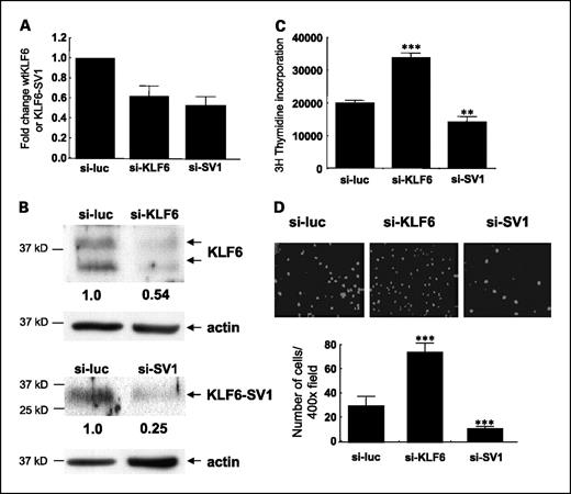 Roles of KLF6 and KLF6-SV1 in Ovarian Cancer Progression and ...
