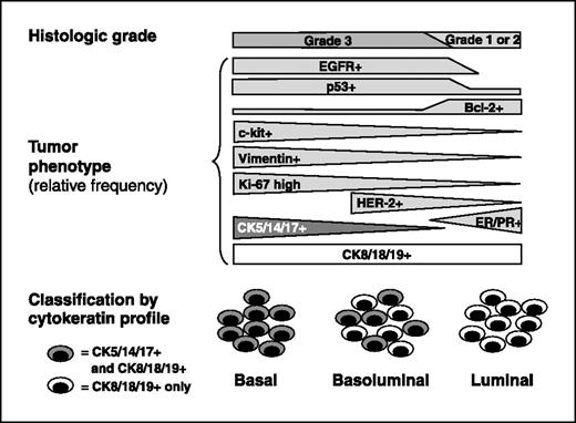 Basoluminal Carcinoma: A New Biologically and Prognostically Distinct ...