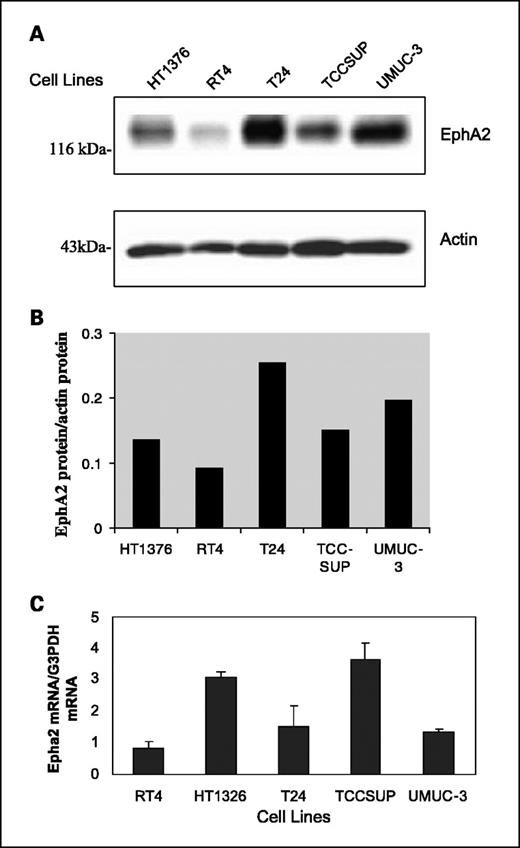 Expression of EphA2 and Ephrin A-1 in Carcinoma of the Urinary Bladder ...