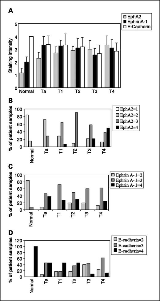 Expression of EphA2 and Ephrin A-1 in Carcinoma of the Urinary Bladder ...