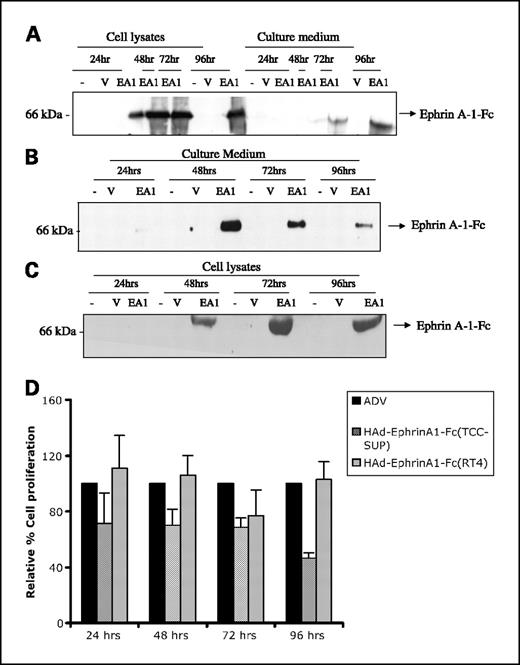 Expression of EphA2 and Ephrin A-1 in Carcinoma of the Urinary Bladder ...