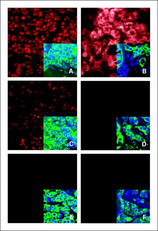 Classification of Breast Cancer Using Genetic Algorithms and Tissue ...