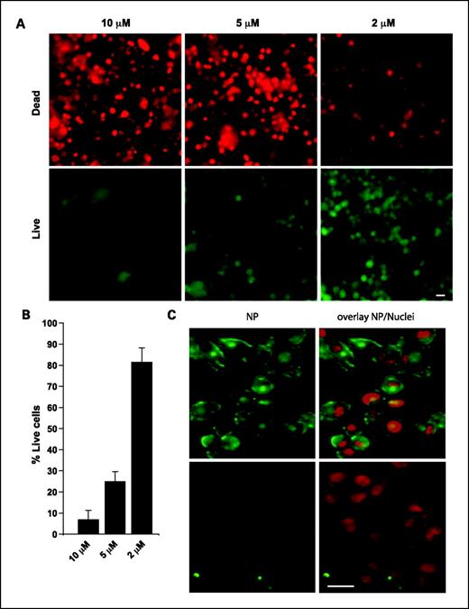 Vascular Targeted Nanoparticles for Imaging and Treatment of Brain ...