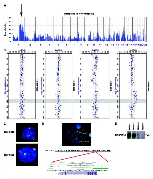 Amplification and Overexpression of CACNA1E Correlates with Relapse in ...