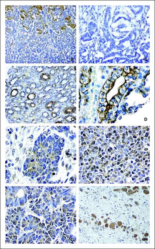 Amplification and Overexpression of CACNA1E Correlates with Relapse in ...