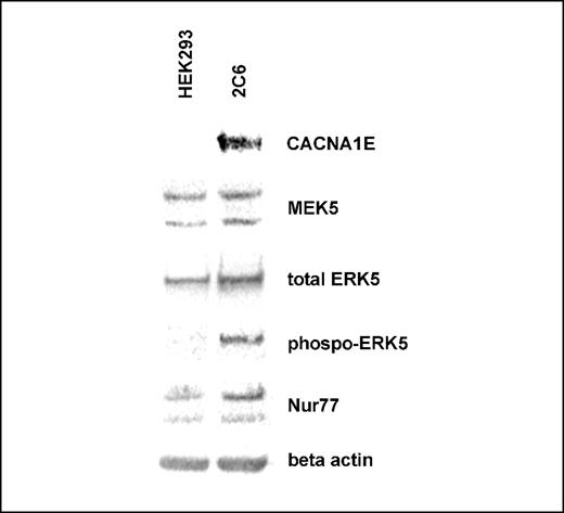 Amplification and Overexpression of CACNA1E Correlates with Relapse in ...