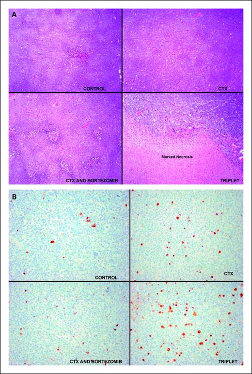 The Combination of the Proteasome Inhibitor Bortezomib and the Bcl-2 ...