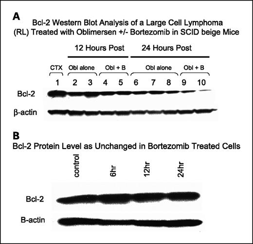 The Combination of the Proteasome Inhibitor Bortezomib and the Bcl-2 ...