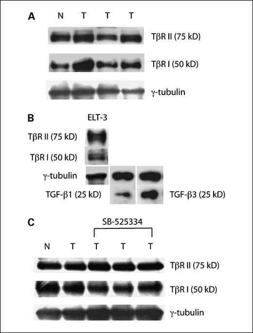 Tumor-Specific Efficacy of Transforming Growth Factor-βRI Inhibition in ...