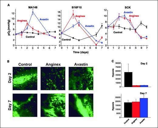 Scheduling of Radiation with Angiogenesis Inhibitors Anginex and ...