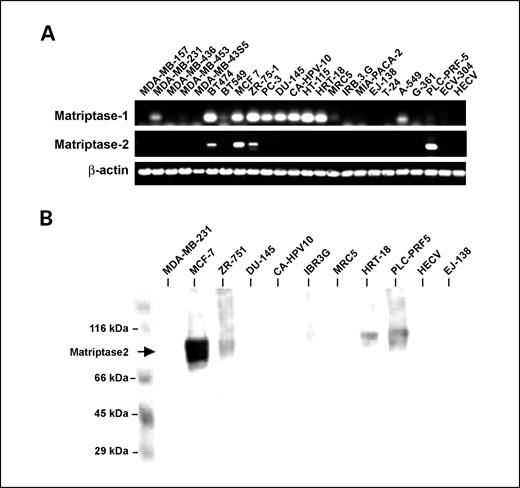 Matriptase-2 Inhibits Breast Tumor Growth and Invasion and Correlates ...