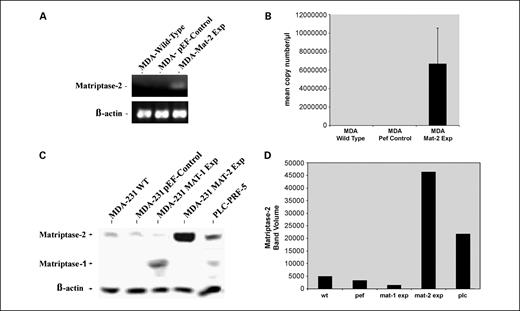 Matriptase-2 Inhibits Breast Tumor Growth and Invasion and Correlates ...