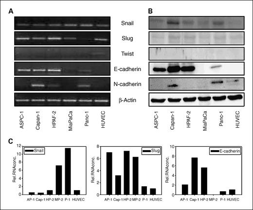 Epithelial to Mesenchymal Transition: Expression of the Regulators ...