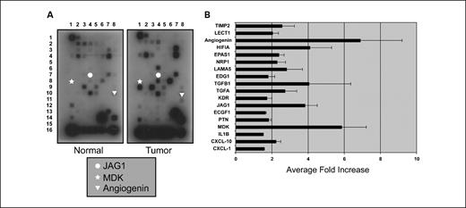Angiogenesis-Promoting Gene Patterns in Alveolar Soft Part Sarcoma ...